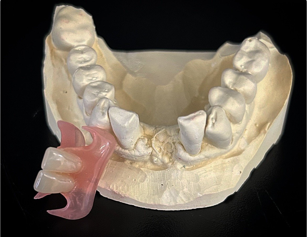 Centrodental Biel Bern Thun Dentallabor Zahnprothetik Zahntechnisches ...